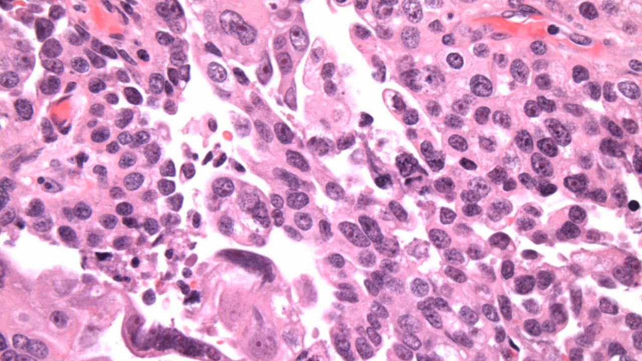 Columbia Ob/Gyn announces Edmée Firth Prize for outcomes research in ...